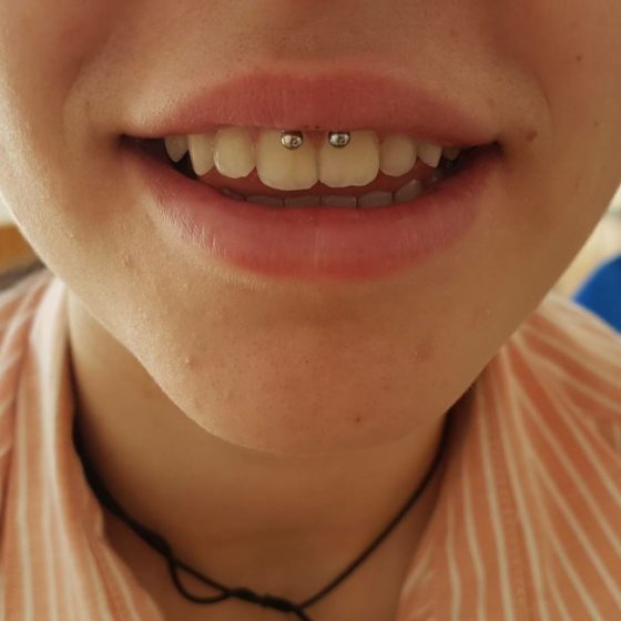 Smiley Piercing [50 Ideas]: Pain Level, Healing Time, Cost, Experience ...