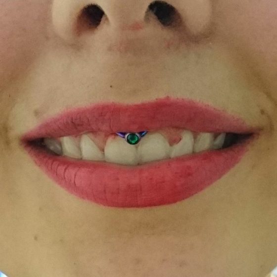 Smiley Piercing [50 Ideas]: Pain Level, Healing Time, Cost, Experience ...