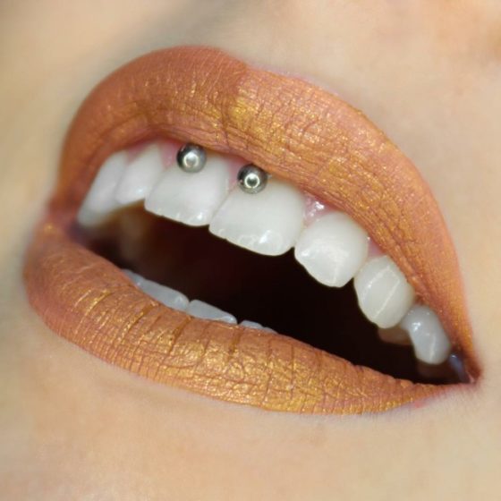 Smiley Piercing [50 Ideas]: Pain Level, Healing Time, Cost, Experience ...