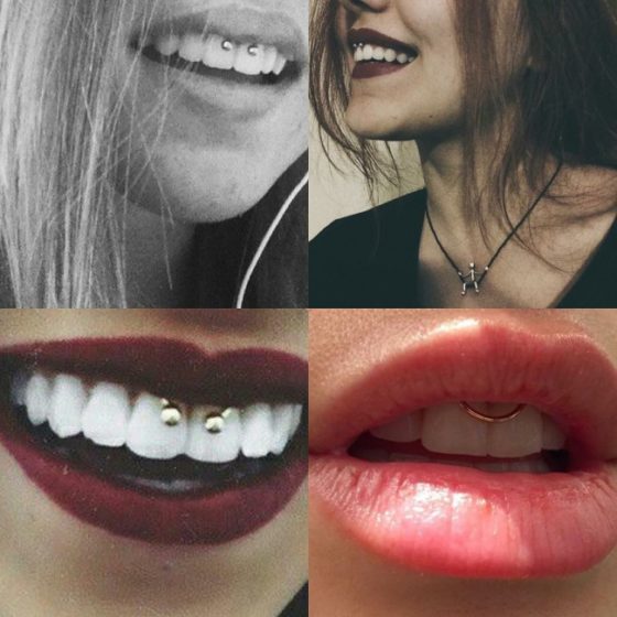 Smiley Piercing [50 Ideas]: Pain Level, Healing Time, Cost, Experience ...